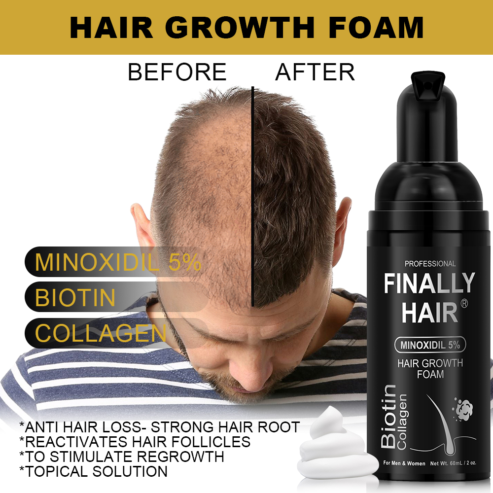 Hair Regrowth Foam 5% Minoxidil Biotin Collagen Unisex Hair Growth ...